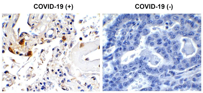 Abcam Anti-SARS-CoV-2 envelope protein antibody, 100µg | LabMart Limited